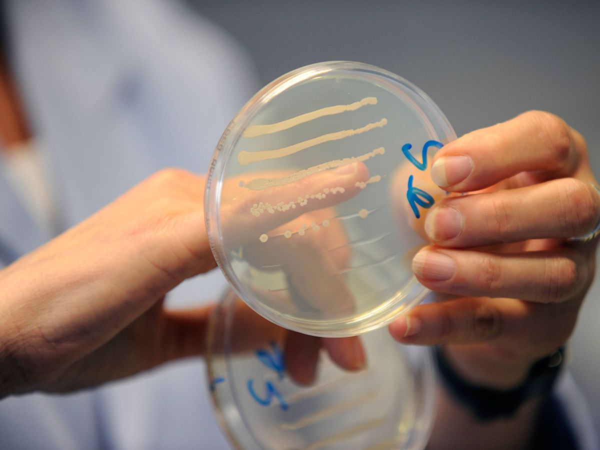 Common mouth bacteria found to ‘melt’ certain cancers in ‘surprising ...