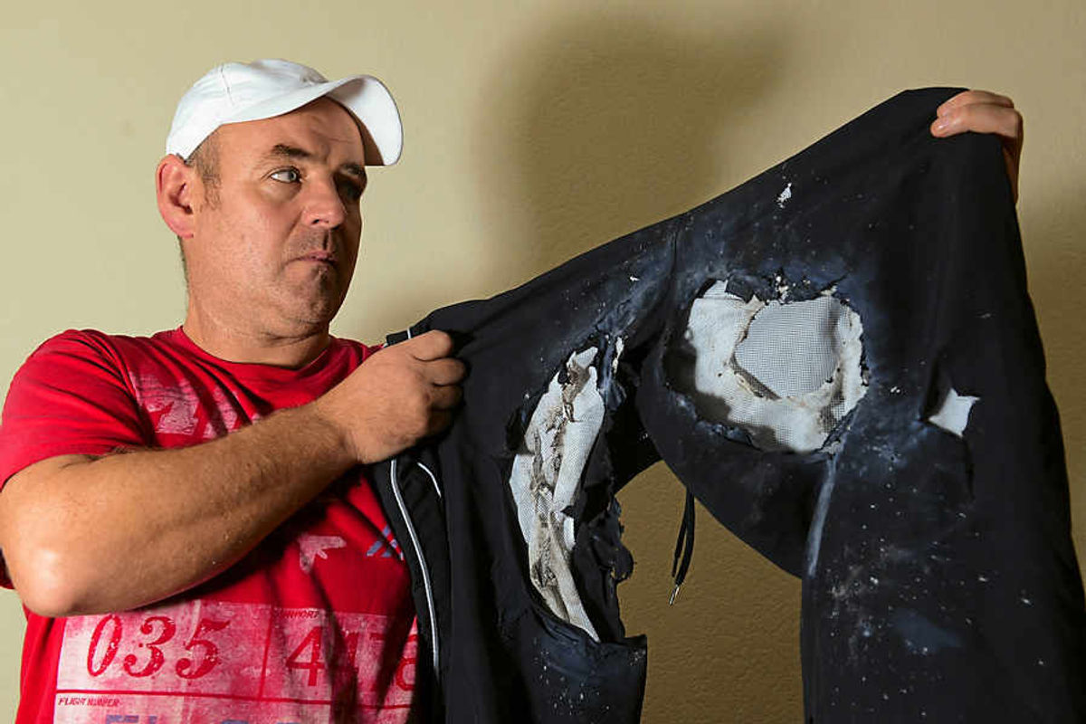 Wednesbury firework victim tells of horror | Express & Star