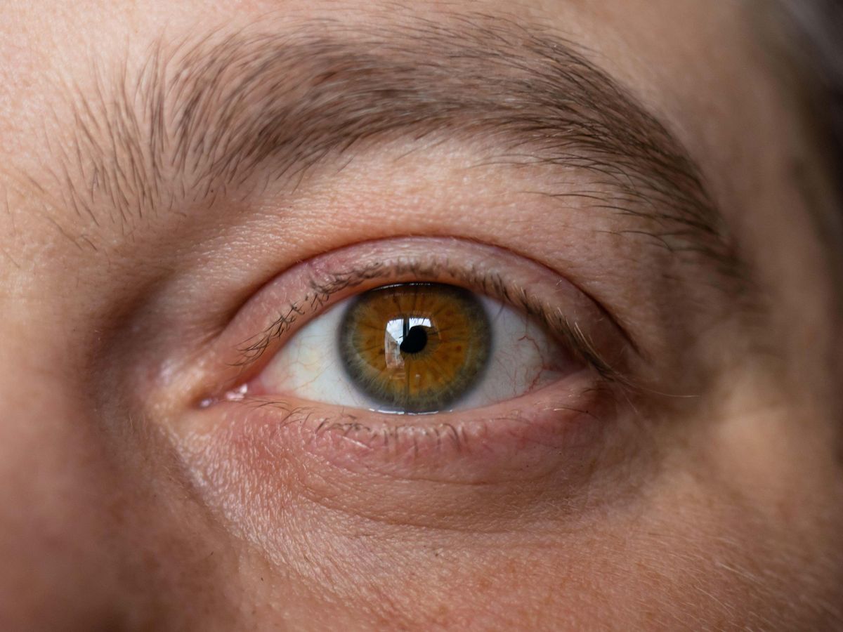 Researchers pinpoint LSD dose that could keep anxiety at bay for weeks ...