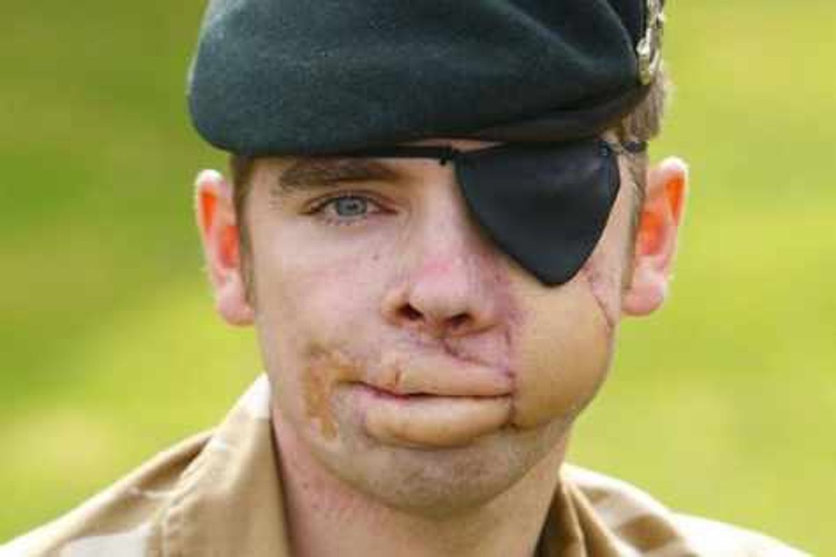 Royal honour for Shropshire soldier injured in Afghanistan | Shropshire ...