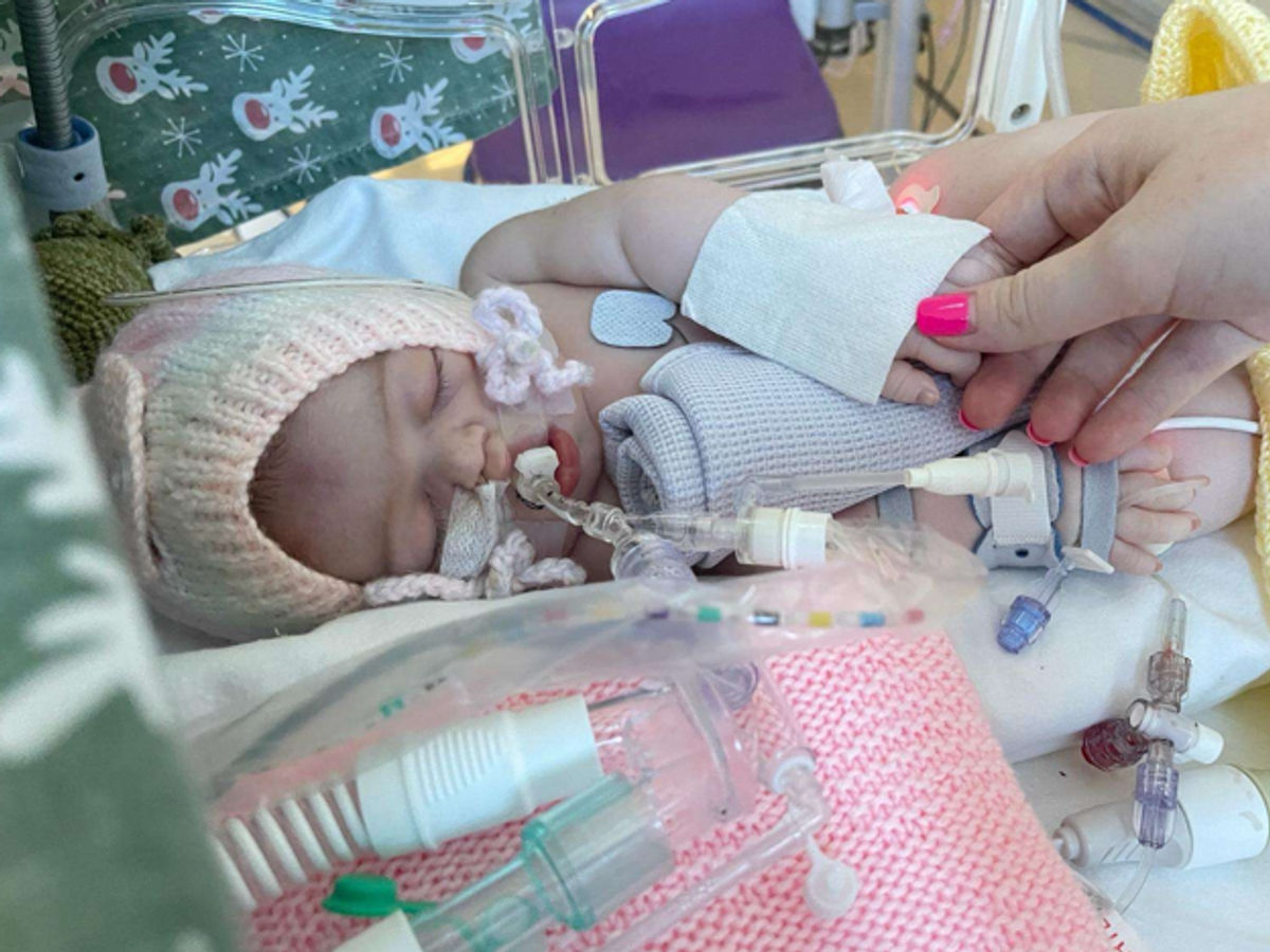 Lab-grown mini-lungs used to test new treatment for rare condition in ...