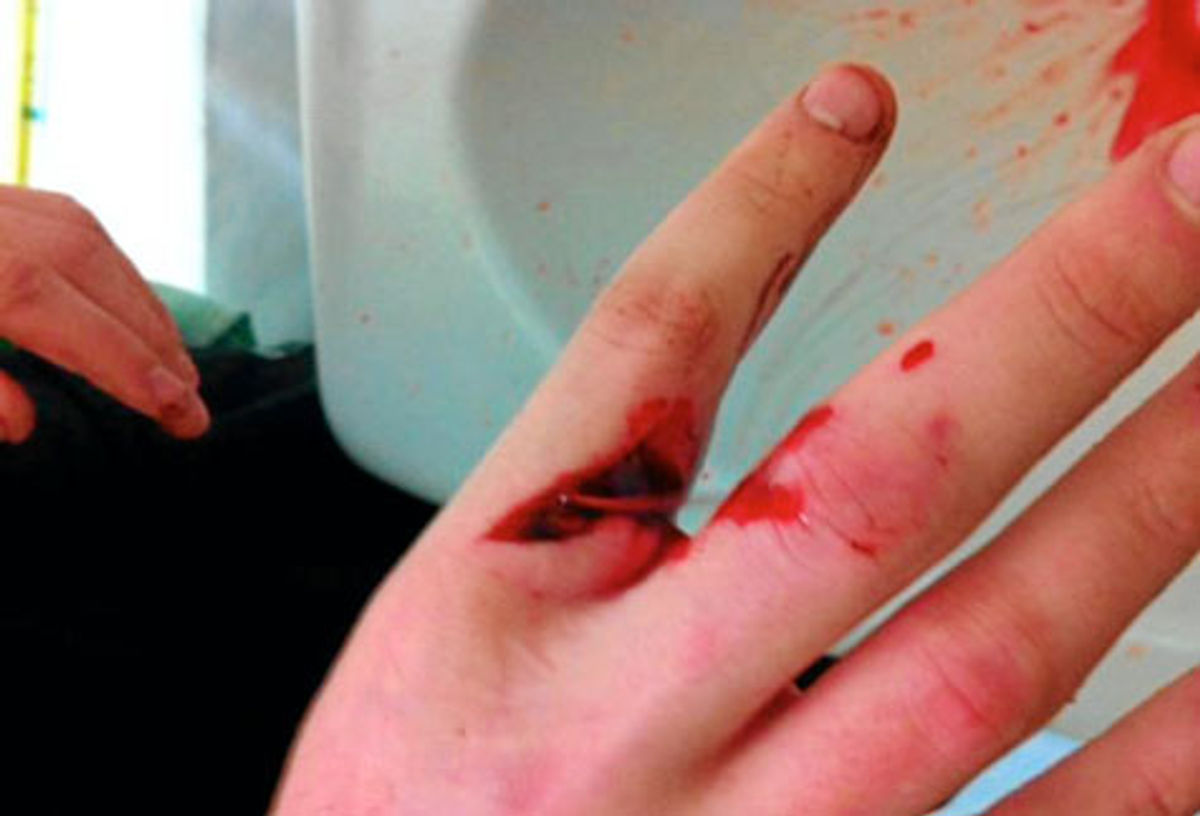 Shocking injuries of machete raid victims | Shropshire Star