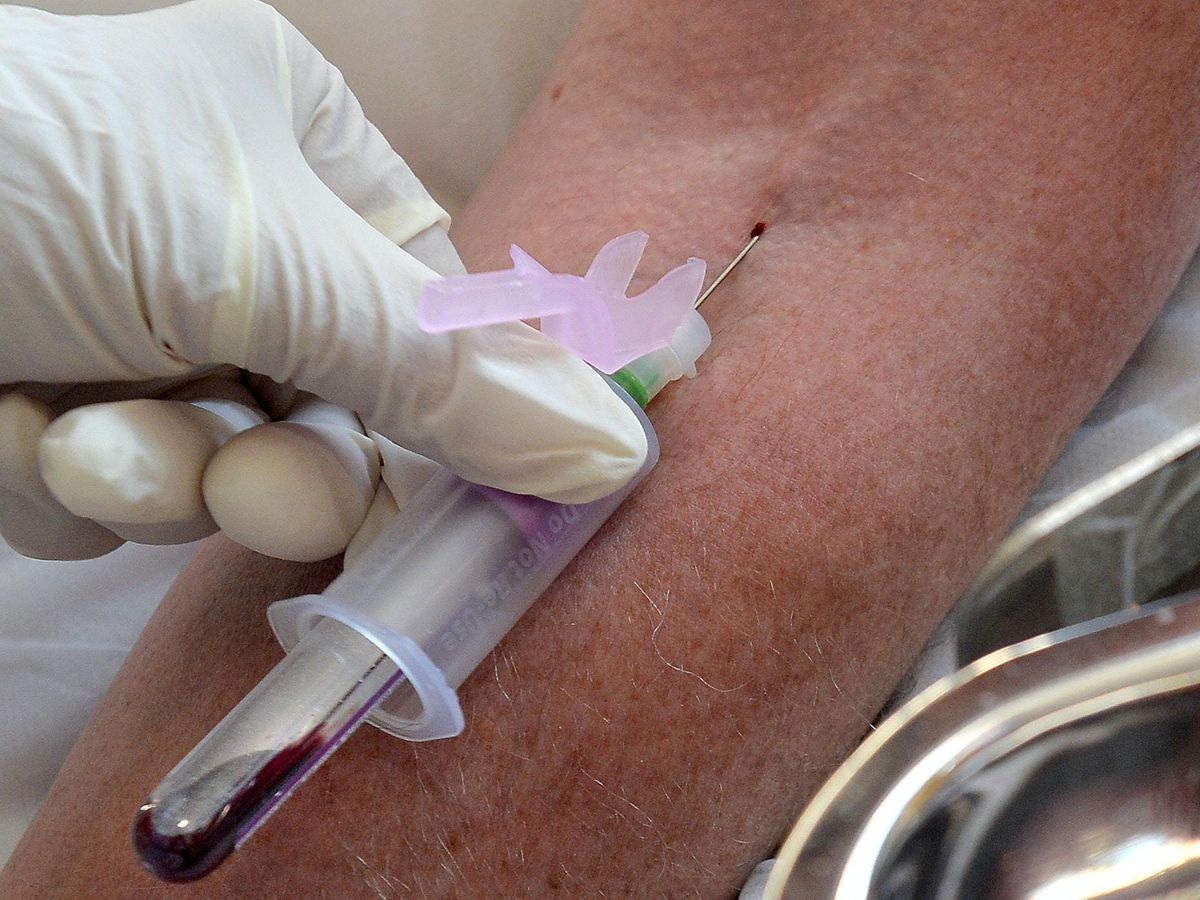 Concern following dip in prostate cancer referrals | Shropshire Star